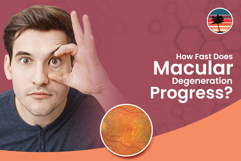How Fast Does Macular Degeneration Progress | AMD Guide