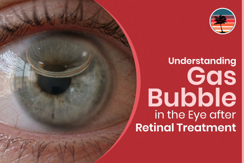 Gas Bubble in the Eye: Types, Recovery and Restrictions